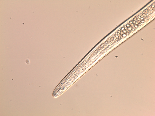 Tylenchus - Applied Nematology, Ecology and Acoustical Signatures