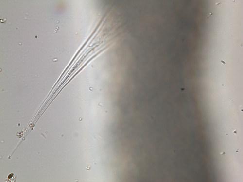 Rhabditidae - Applied Nematology, Ecology and Acoustical Signatures