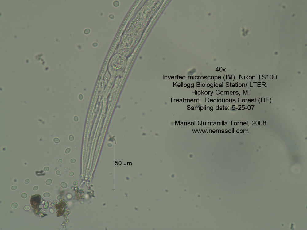 Acrobeles - Applied Nematology, Ecology and Acoustical Signatures