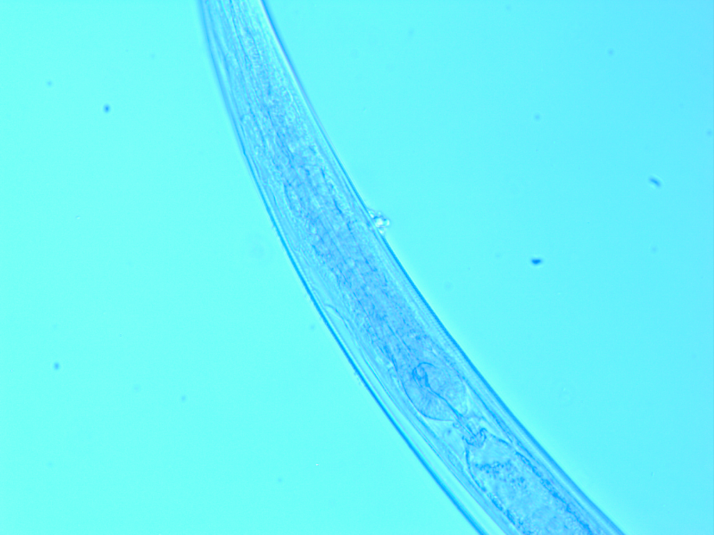 Plectus - Applied Nematology, Ecology and Acoustical Signatures